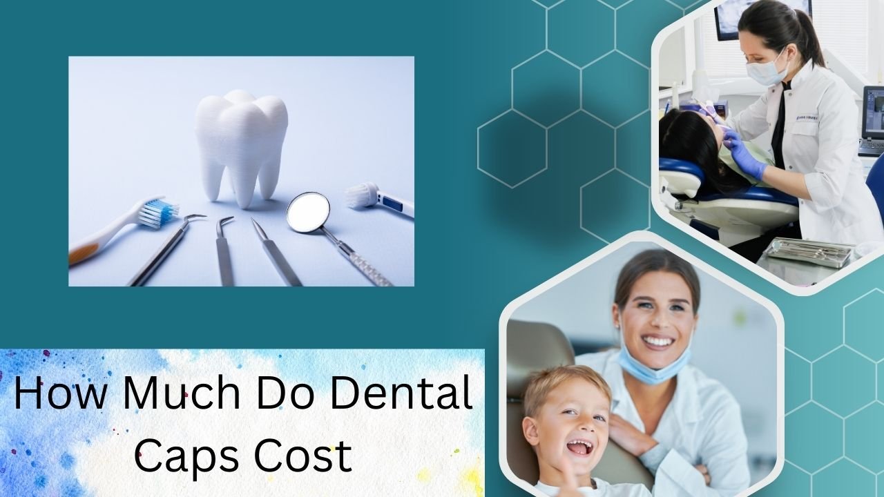 How Much Do Dental Caps Cost - The Dental Healers