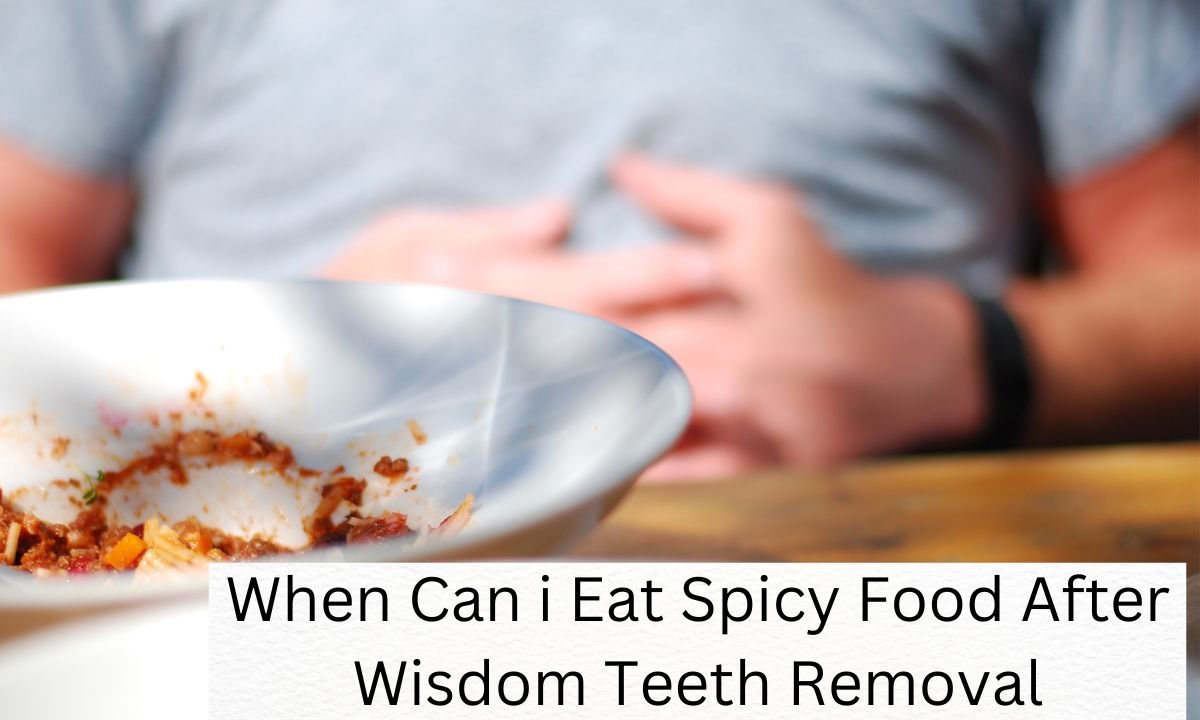 When Can I Eat Spicy Food After Wisdom Teeth Removal? - The Dental Healers