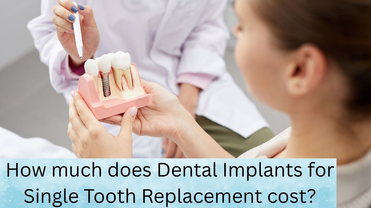 How much does Dental Implants for Single Tooth Replacement cost? - The ...