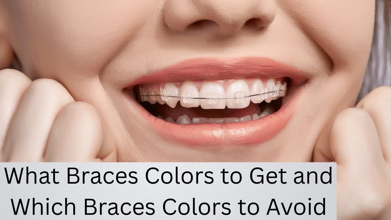 What Braces Colors to Get and Which Braces Colors to Avoid - The Dental ...